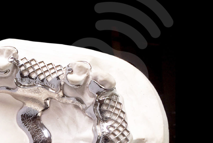 Trincas em Metalocerâmica! Como evitar? - Blog Protético